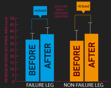 Volume Load Does Not Drive Muscle Hypertrophy - House of Hypertrophy